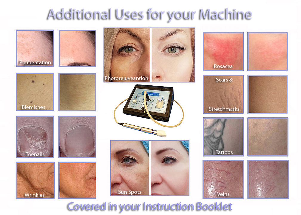 IPL750 Professional Pulsed Light Wrinkle Treatment System. – Avance Beauty