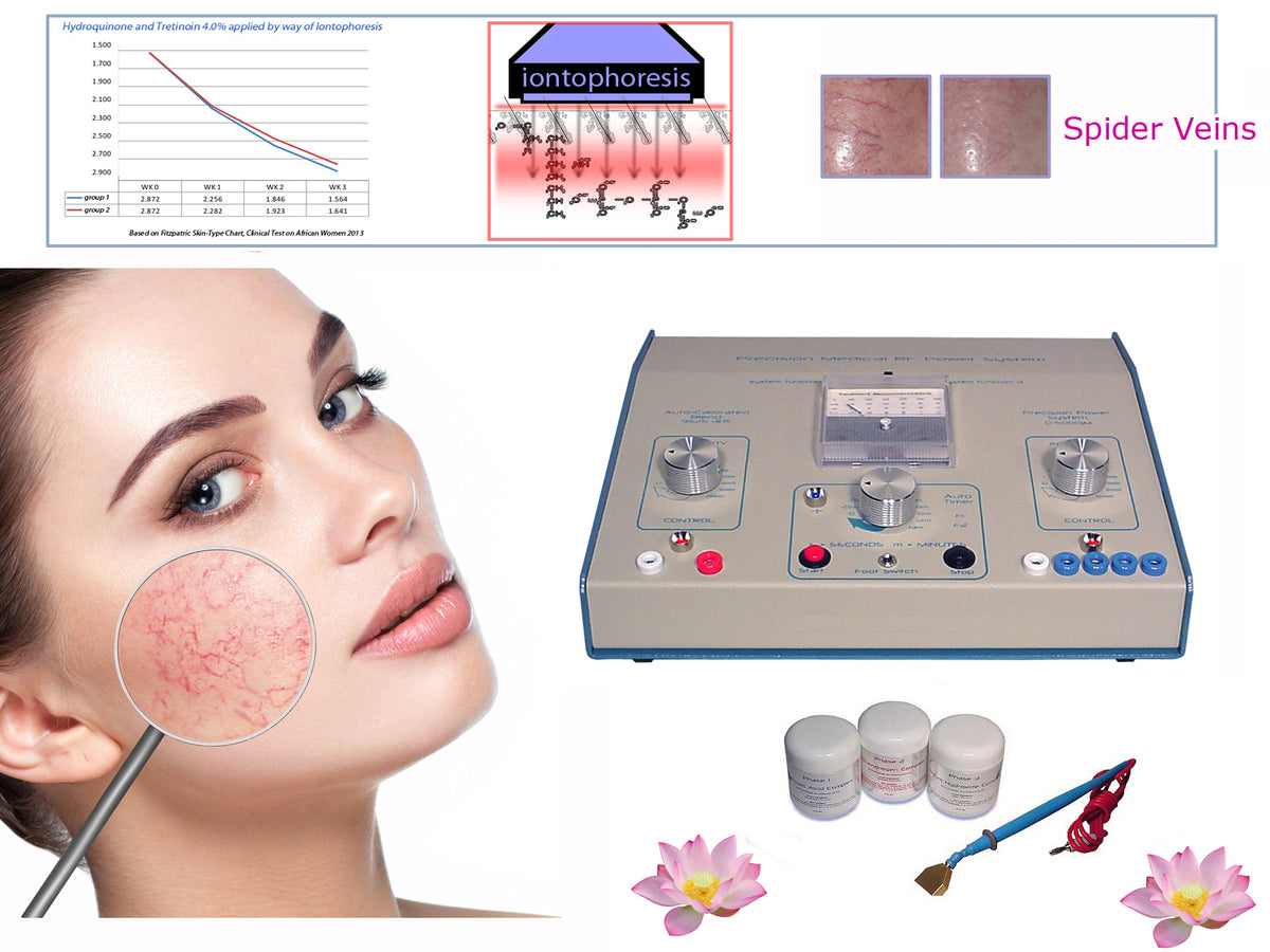 Professional Vascular, Vein, Capillary, Rosacea Reduction System Non L ...