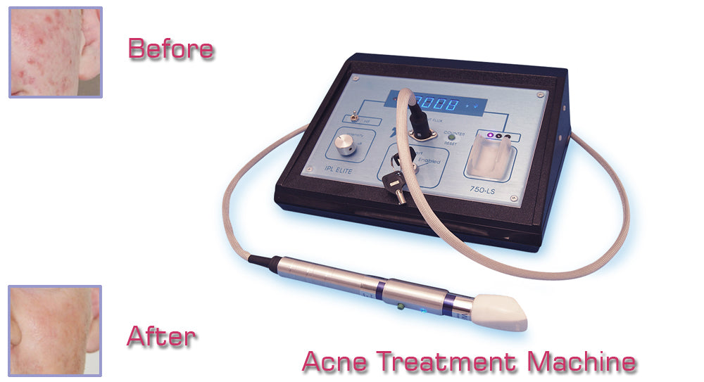 Acne Treatment LED IPL Machine, Salon & Home System, Best High Quality ...